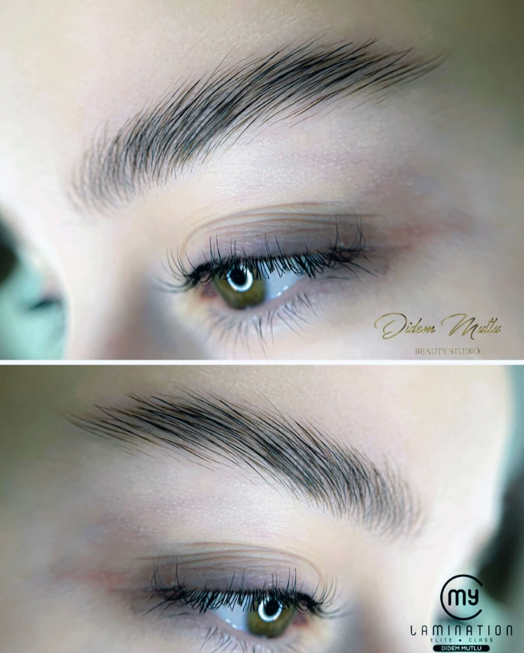 Kaş Botoksu | My Lamination Türkiye